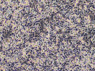 表达HBV病毒的人肝细胞；HepG2.2.15(STR) - 上海富衡生物科技有限公司