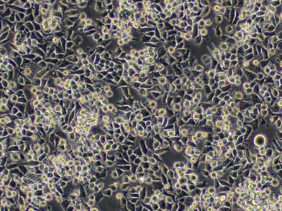 人肝癌细胞；SNU-398(STR) - 上海富衡生物科技有限公司