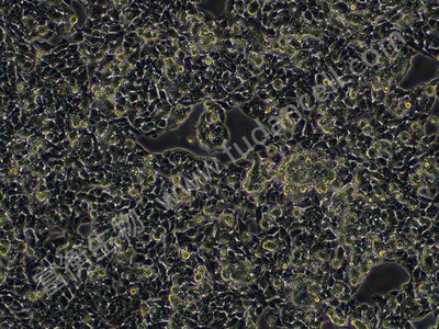 人肝癌细胞；HepG2(STR) - 上海富衡生物科技有限公司