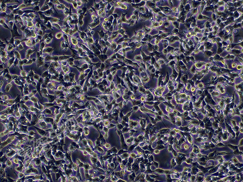人神经母细胞瘤细胞；SH-SY5Y(STR) - 上海富衡生物科技有限公司