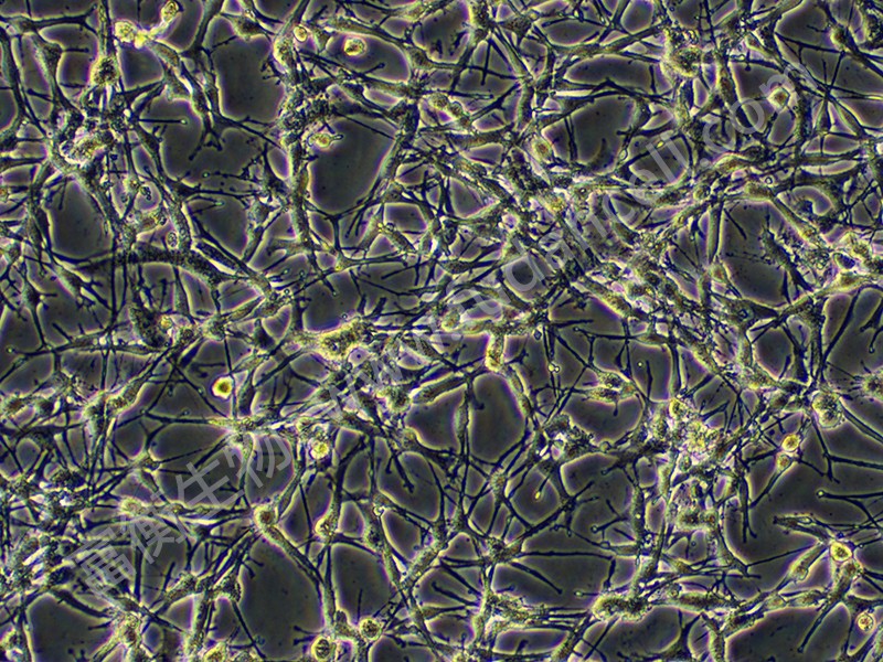 人胶质母细胞瘤细胞；A172(STR) - 上海富衡生物科技有限公司