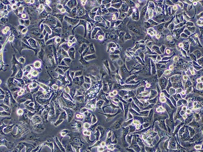 人乳腺腺癌细胞；SK-BR-3(STR) - 上海富衡生物科技有限公司