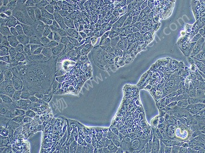 人胰腺癌细胞；HPAF-II(STR) - 上海富衡生物科技有限公司