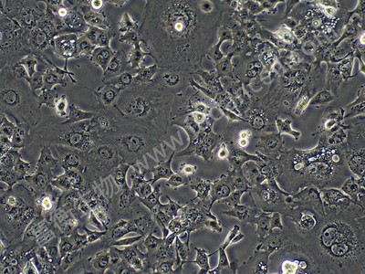 人胃癌细胞；Hs746T(STR) - 上海富衡生物科技有限公司