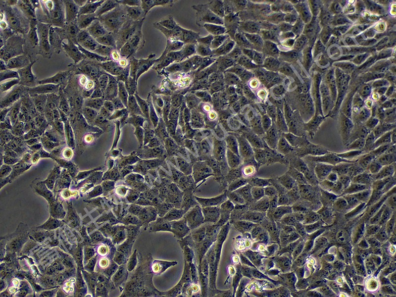 人骨肉瘤细胞；143B(STR) - 上海富衡生物科技有限公司