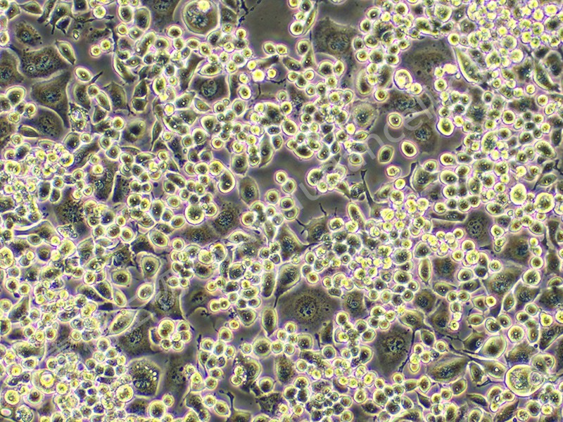 小鼠脑神经瘤细胞；Neuro-2a(STR) - 上海富衡生物科技有限公司