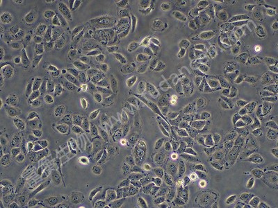 人膀胱癌细胞带荧光素酶；5637/Luc(STR) - 上海富衡生物科技有限公司