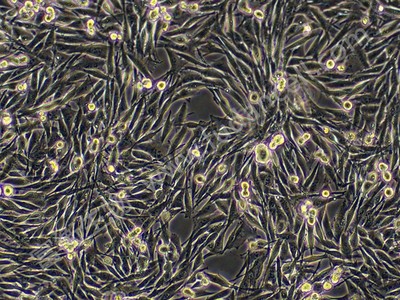 人眼脉络黑色素瘤细胞；OCM1 - 上海富衡生物科技有限公司