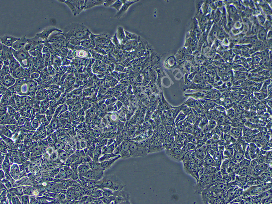 人非小细胞肺癌细胞；NCI-H358(STR) - 上海富衡生物科技有限公司