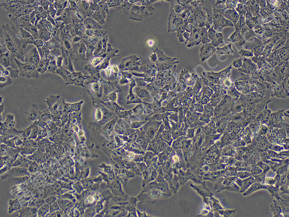 人肝癌细胞；Huh7.5.1(STR) - 上海富衡生物科技有限公司