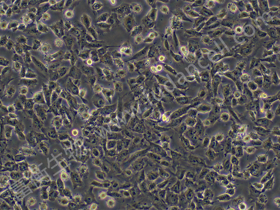 人侵袭性脉络膜黑色素瘤细胞；MUM2B(STR) - 优质细胞资源 - 上海富衡生物科技有限公司