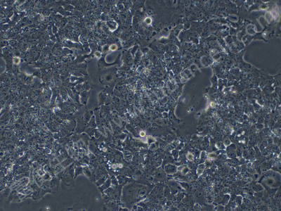 人肺鳞癌细胞；NCI-H2170(STR) - 上海富衡生物科技有限公司
