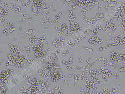 人结直肠腺癌细胞；COLO320DM (STR) - 上海富衡生物科技有限公司