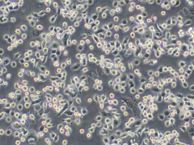 人胰腺癌细胞；AsPC-1(STR) - 上海富衡生物科技有限公司