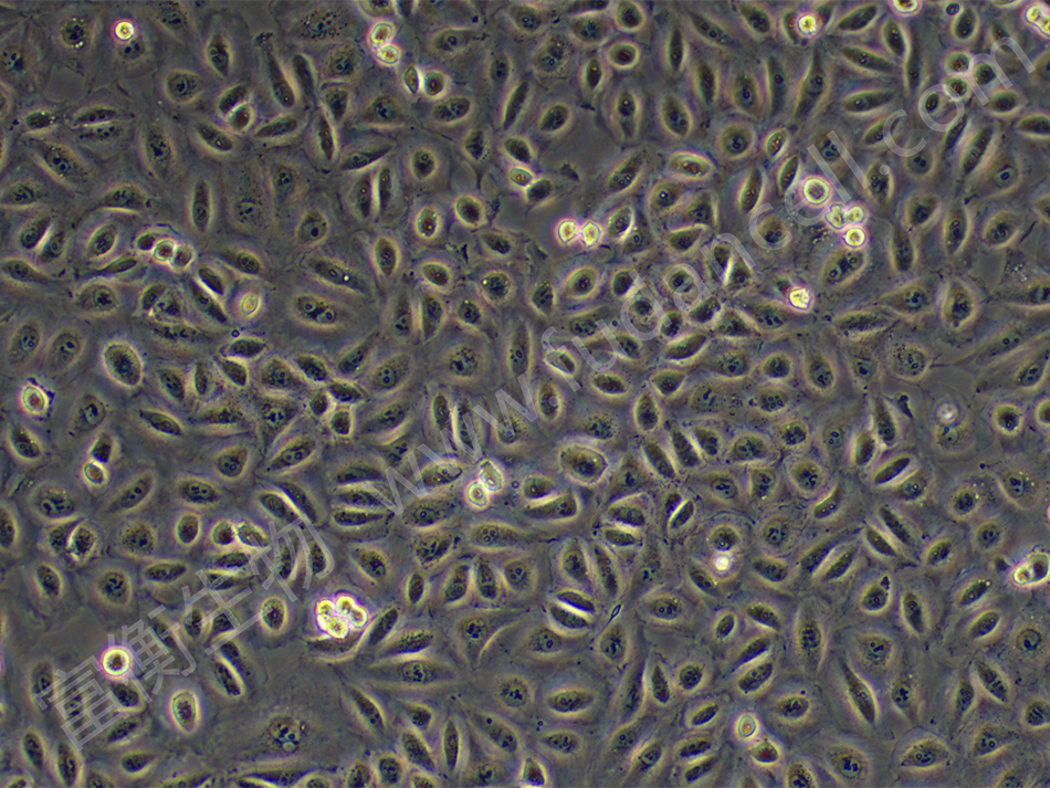人肺腺癌耐顺铂株；A549/DDP (STR) - 上海富衡生物科技有限公司