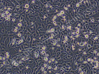 人宫颈癌细胞；Hela-s3(STR) - 上海富衡生物科技有限公司