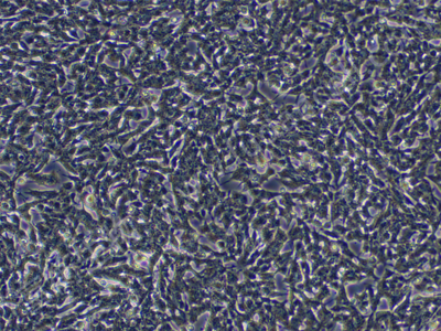 人舌鳞癌细胞；SCC-4(STR) - 上海富衡生物科技有限公司