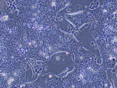 人结肠直肠腺癌细胞；NCI-H508(STR) - 上海富衡生物科技有限公司