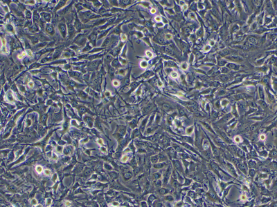 小鼠脑微血管内皮细胞株；bend.3(STR) - 上海富衡生物科技有限公司