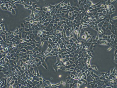 人非小细胞肺癌细胞系；NCI-H322(STR) - 上海富衡生物科技有限公司