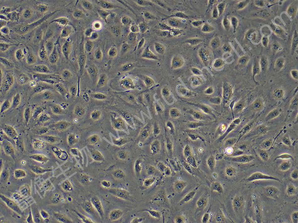 人脐静脉血管内皮细胞带红色荧光；HUVEC/RFP(STR) - 上海富衡生物科技有限公司