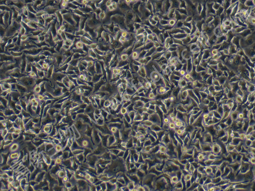 小鼠黑色素瘤细胞转染OVA；B16/OVA(STR) - 上海富衡生物科技有限公司