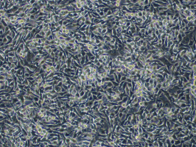 小鼠黑色素瘤细胞转染OVA；B16-F10/OVA(STR) - 上海富衡生物科技有限公司