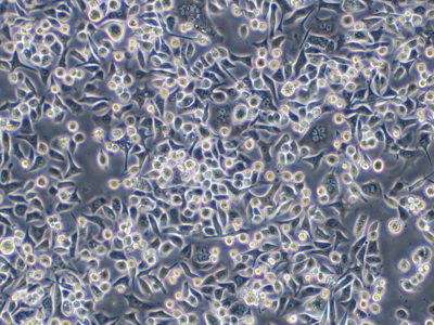 人胃癌细胞；SNU601(STR) - 上海富衡生物科技有限公司