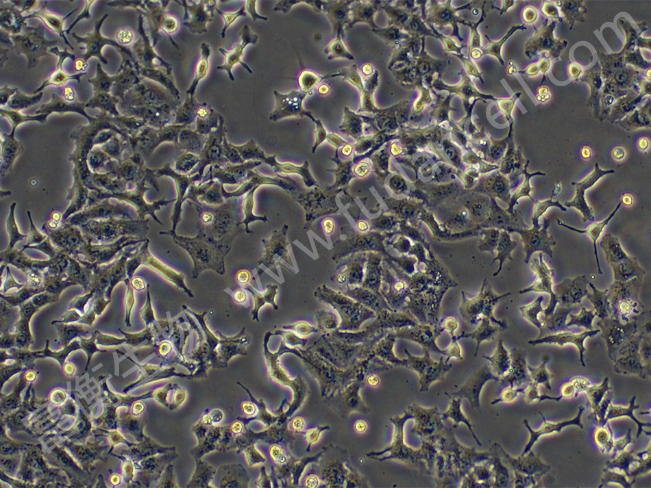 人胶质瘤细胞；U373(STR U251交叉污染) - 上海富衡生物科技有限公司