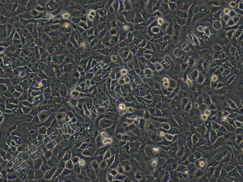 人乳腺癌细胞；Hcc1806(STR) - 上海富衡生物科技有限公司