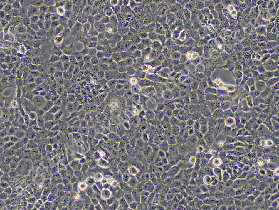 人滋养细胞；HTR-8/SVneo(STR) - 上海富衡生物科技有限公司