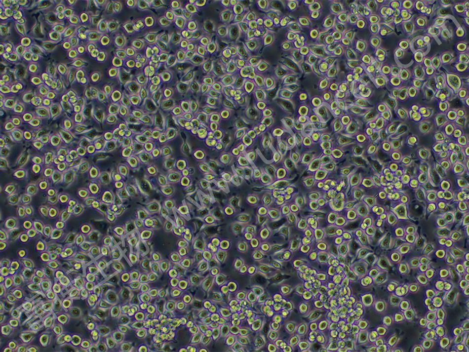 人肺癌细胞；NCI-H2122(STR) - 上海富衡生物科技有限公司