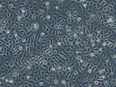 人支气管上皮样细胞；HBE HBE135-E6E7[ATCC® CRL-2741](STR) - 上海富衡生物科技有限公司