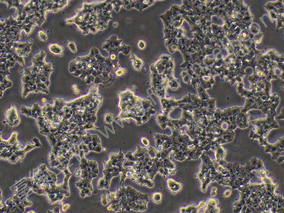 小鼠胰岛β细胞株；Min6（种属鉴定） - 上海富衡生物科技有限公司