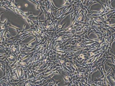 小鼠黑色素瘤细胞；YUMM1.7(STR) - 上海富衡生物科技有限公司