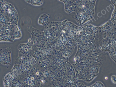 人结肠癌细胞；SW1116(STR) - 上海富衡生物科技有限公司