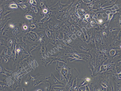人乳腺导管癌细胞；HCC38(STR) - 上海富衡生物科技有限公司