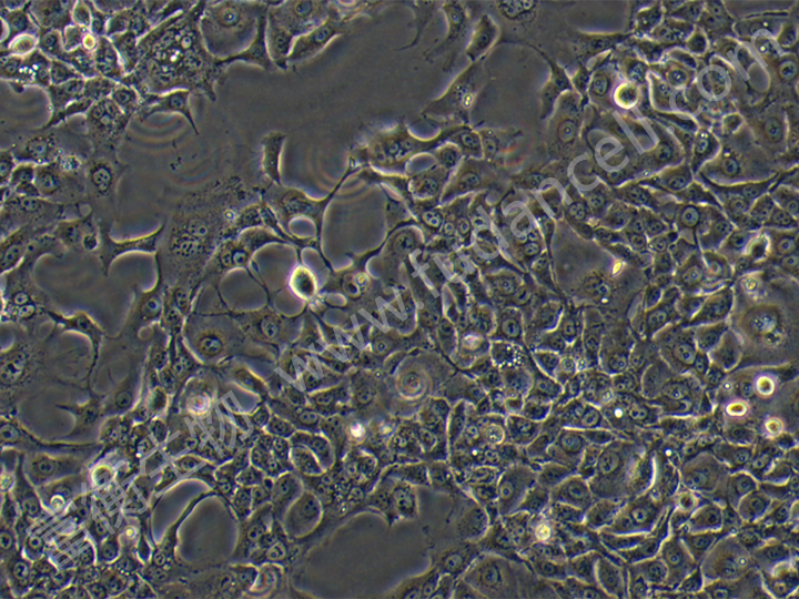 人非小细胞肺癌细胞；HCC827 (STR) - 上海富衡生物科技有限公司