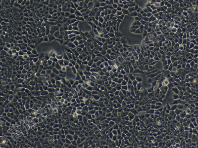 人乳腺癌细胞；MCF-7(STR) - 上海富衡生物科技有限公司
