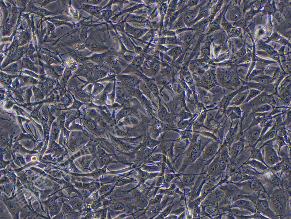 人胶质母细胞瘤细胞；A172(STR) - 上海富衡生物科技有限公司