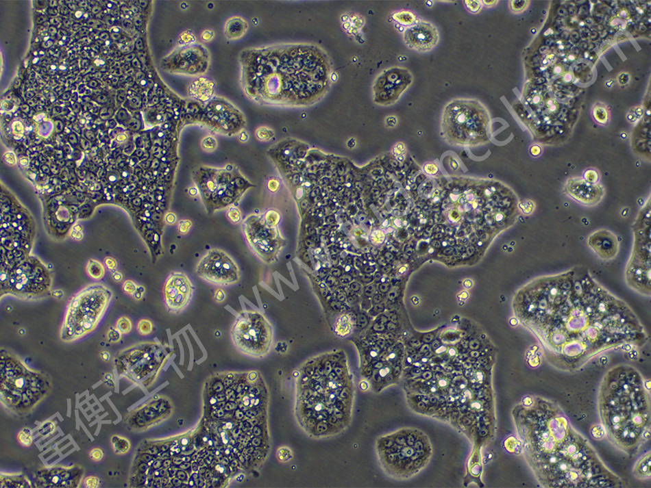 人胃癌细胞；NCI-N87(STR) - 上海富衡生物科技有限公司