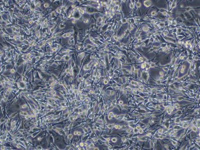 小鼠肺腺癌细胞；LA795(STR) - 上海富衡生物科技有限公司