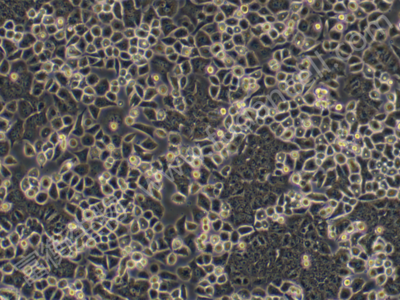 人结肠癌细胞；HCT-8(STR) - 上海富衡生物科技有限公司