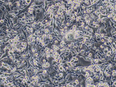 小鼠膀胱癌细胞荧光素酶；MB49/LUC(STR) - 上海富衡生物科技有限公司