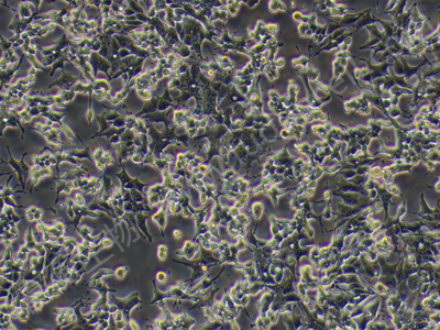 人前列腺癌细胞；22Rv1(STR) - 上海富衡生物科技有限公司