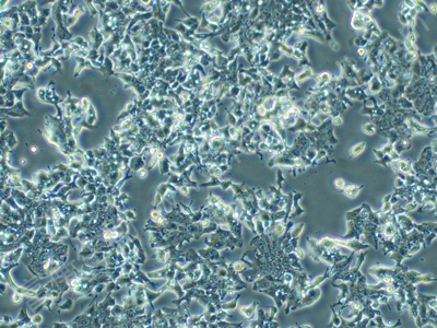 人结肠腺癌细胞；LS1034 - 上海富衡生物科技有限公司