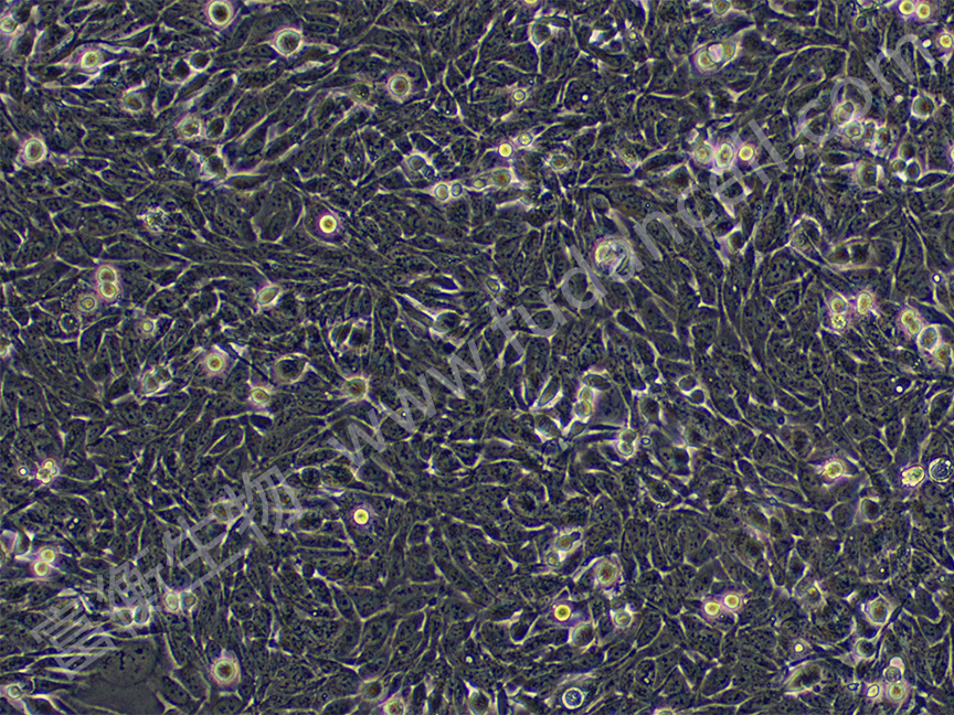 人胃癌细胞；NUGC-3 - 上海富衡生物科技有限公司