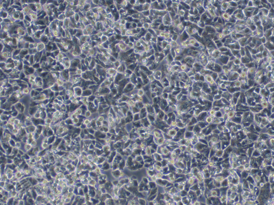 人小细胞肺癌；NCI-H1048(STR) - 上海富衡生物科技有限公司